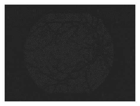 Microaneurysm Detection A Original Retina Image B Clahe Contrast Download Scientific