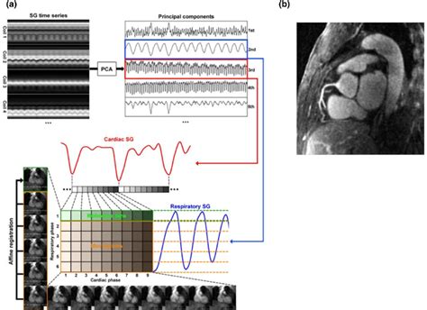 Schematics Of The Proposed Self Gating Data Binning And Respiratory