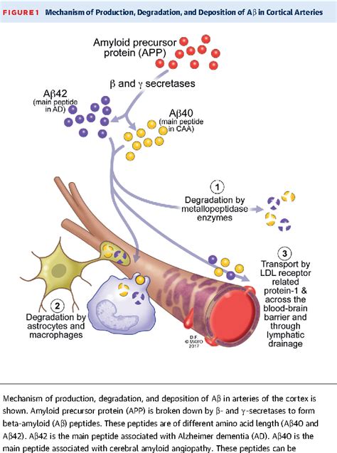 Amyloid Angiopathy Treatment Cerebral Amyloid Angiopathy Dgam
