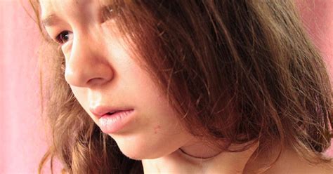 Nutcracker Esophagus Explanation Symptoms Causes And Treatments