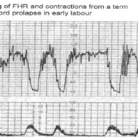 The Percentage Of Different Opinions On Ctg In Illustration 3 By The Download Scientific