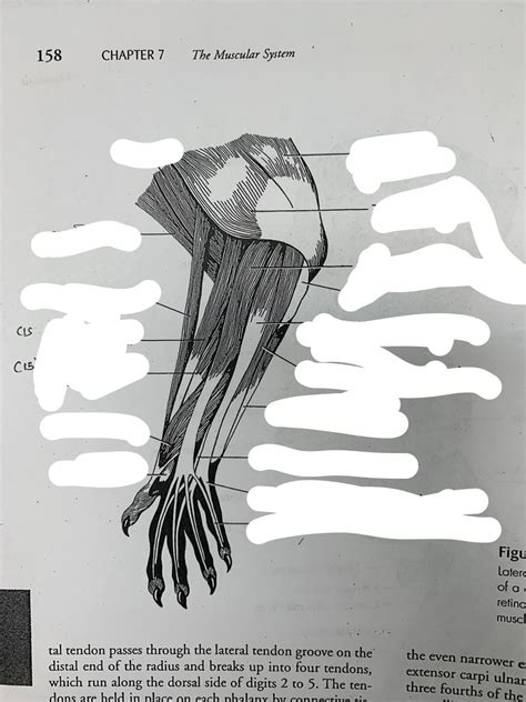Extensors Diagram Quizlet