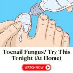 Vinegar Soak For Toenail Fungus Can It Cure Toenail Fungus