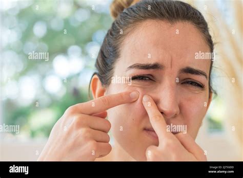 Portrait Of A Woman Exploding A Pimple On Her Face And With An Expression Of Pain Stock Photo