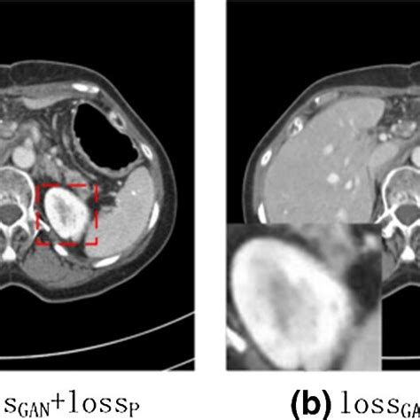 The Comparison Of Denoising Effects Of Different Algorithms Download