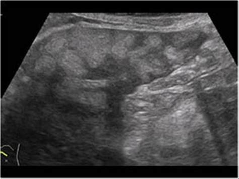 Gan Nhi M M Ca L M S Ng