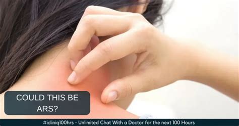 I Have A Rash And Swollen Lymph Node After Oral Sex Why