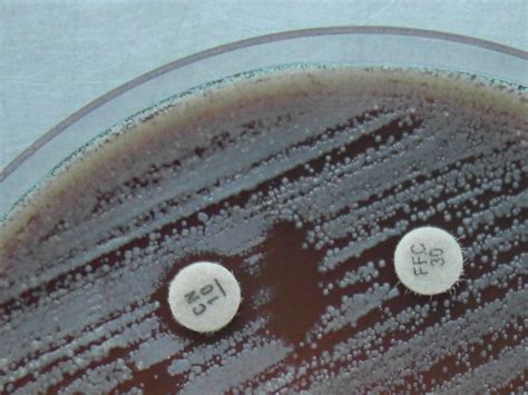 Regnum Prokaryotae Antibiogram