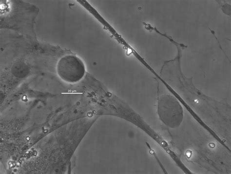 What Could Be These Spherical Structures Among Cells Researchgate