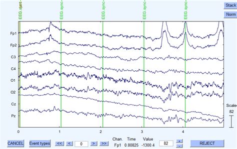 Fast And Simple Eye Tracking And Eeg Setup Using A Mobile Phone
