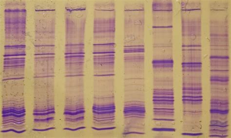 Cell Line Authentication Your Source For Expert Cell Line Authentication Services