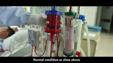 Mg Hemoperfusion Cartridge Sop Youtube