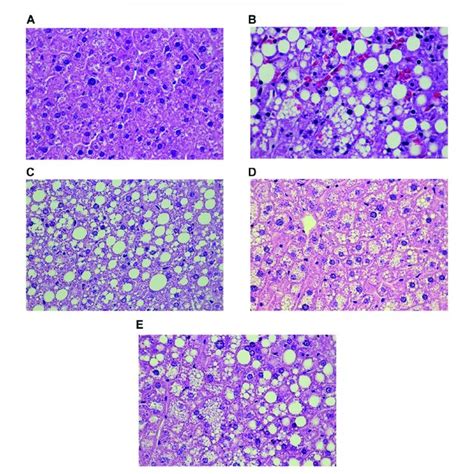 A The Body Weight Of The Control And Dio Mice During Dietary