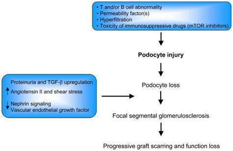 Recent Progress In The Pathophysiology And Treatment Of Fsgs Recurrence