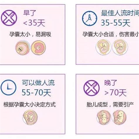 引产和人流并是同一件事吗？手术胎儿进行