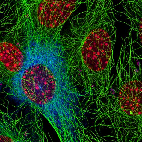 Confocal Microscopy