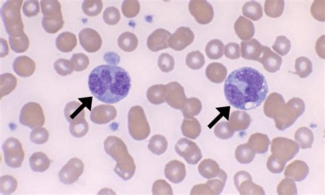 Monocytes Cells And Smears