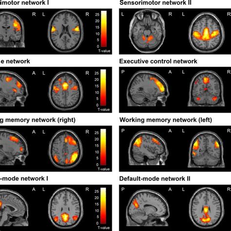 Spatial Maps Of Selected Resting State Networks Rsns From The Group Download Scientific