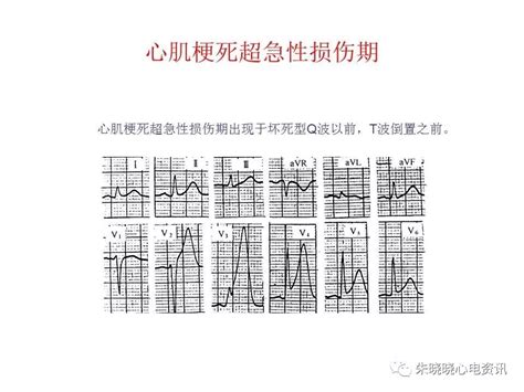 文章详情