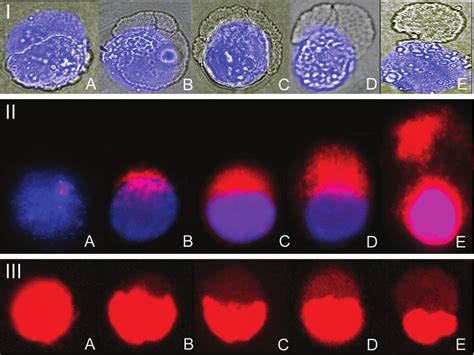 Nuclear Blebs In Mycobacteria Infected Macrophages Panel I Download Scientific Diagram