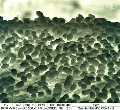 Enterococcus Faecalis Community Enterococcus Faecalis Colo Flickr