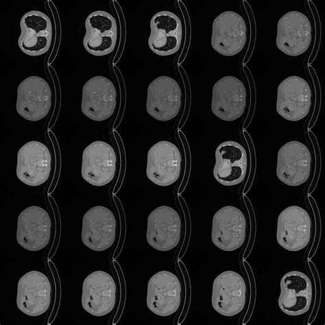 Read D NIFTI Images In Python Idiot Developer