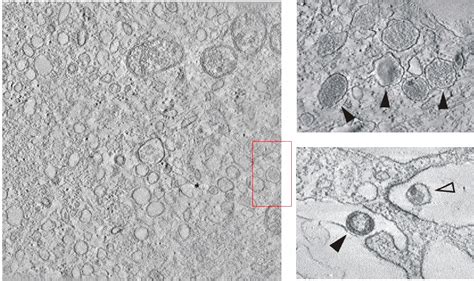 Figure 1 From An Energy Based Three Dimensional Segmentation Approach For The Quantitative