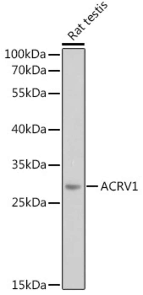 Acrosomal Vesicle Protein Polyclonal Antibody Invitrogen 100 μl