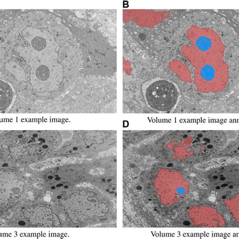 Example Image Slices And Corresponding Ground Truth Annotations From Download Scientific