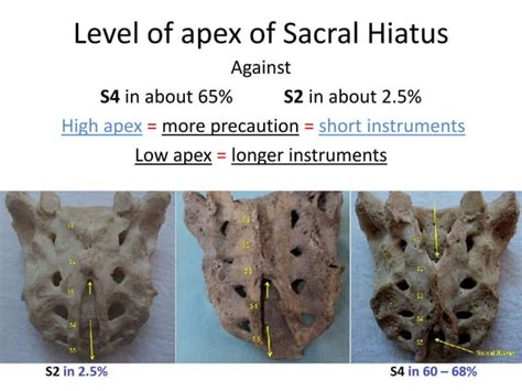 Anatomic Basis Of Epiduroscopy Pptx