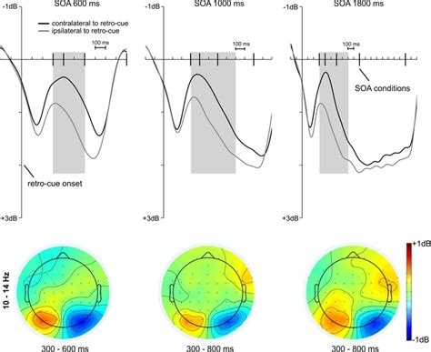 Posterior Asymmetries Po78 In Induced Alpha Power 1014 Hz The