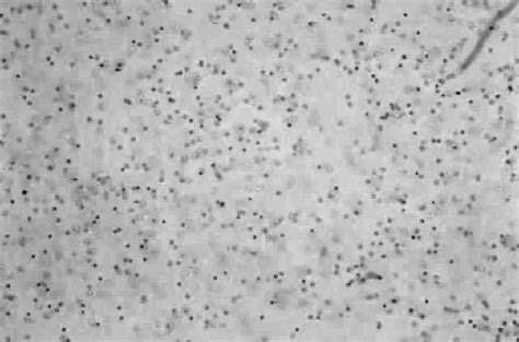 Trackpy Walkthrough Zephyrs Blog