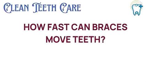 The Surprising Speed Of Braces How Quickly Can Teeth Shift