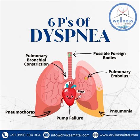 How Dyspnea Affects Breathing And Lung Health Wellness Home Posted On The Topic Linkedin
