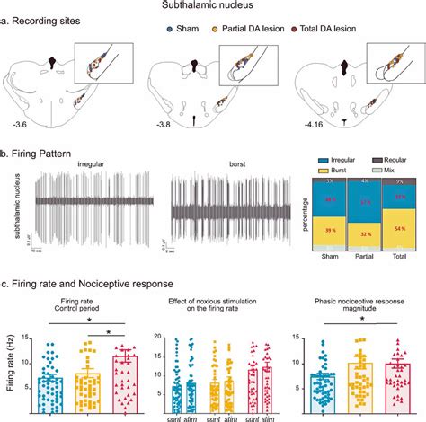 Subthalamic Nucleus Histological And Electrophysiological Results A Download Scientific