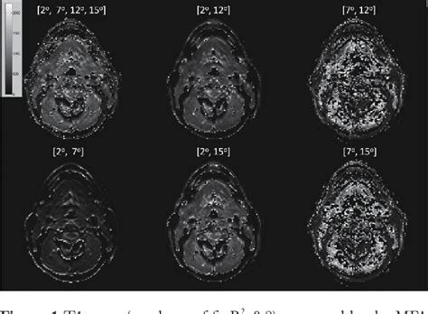 Figure 1 From Quantitative Evaluation Of Dual Flip Angle T1 Mapping On Dce Mri Kinetic Parameter