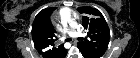 Pregnant Women And Medical Imaging Tests What You Need To Know