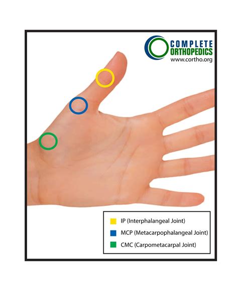 Metacarpophalangeal Joint Thumb