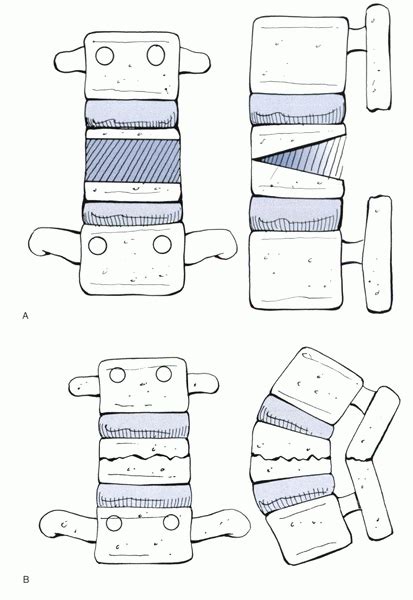 Pathologic Reflexes Teachme Orthopedics