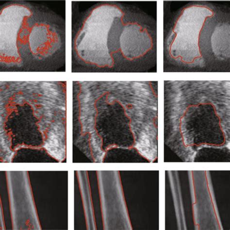 Comparisons Among Our Model Drlse And Lsacm Download Scientific Diagram