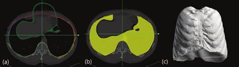 Extracting The Thoracic Cavity Volume A Five Thoracic Surfaces The Download Scientific