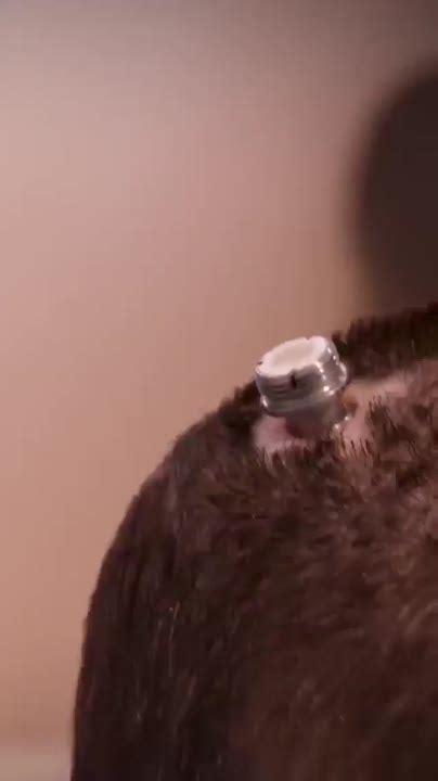 Prerna Koirala On Linkedin Ai Aicommunity Healthcareanalytics