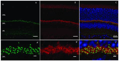 Hrg4unc119 Is Expressed In The Outer Plexiform Layer Of Murine Download Scientific Diagram