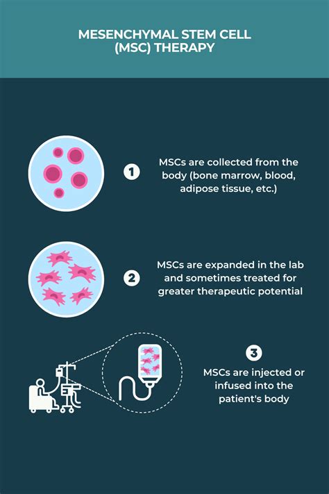 Stem Cell Therapy For Ms Multiple Sclerosis News Today