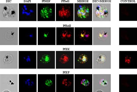 Indirect Immunofluorescence Assay And Confocal Microscopy To Localize