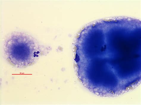 Huge Fragments Of Megakaryocyte Cytoplasm Of The Feathered Edge Of A