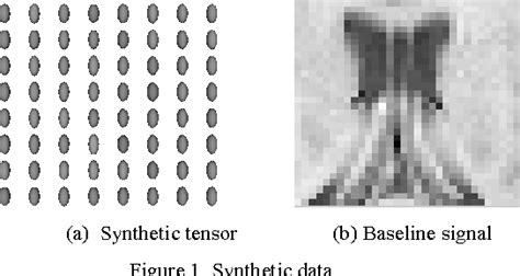 figure 1 from a new dti image denoising method based on shearlet