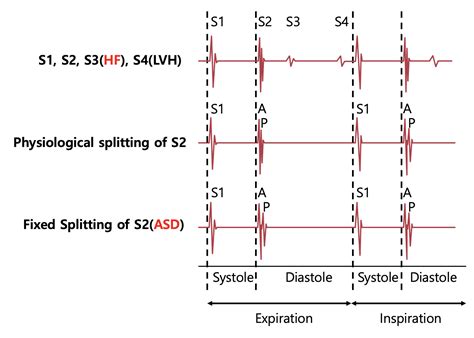 heart sound 메디톡