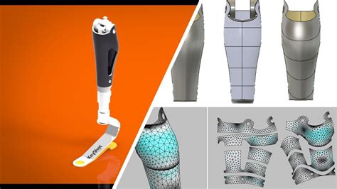 Reducing The Costs Of Prosthetic Manufacturing — Digital Patterning For