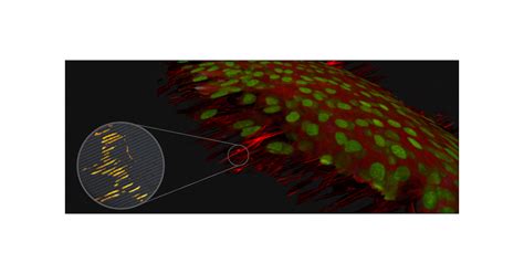 Nanoengineered Surfaces For Focal Adhesion Guidance Trigger Mesenchymal Stem Cell Self